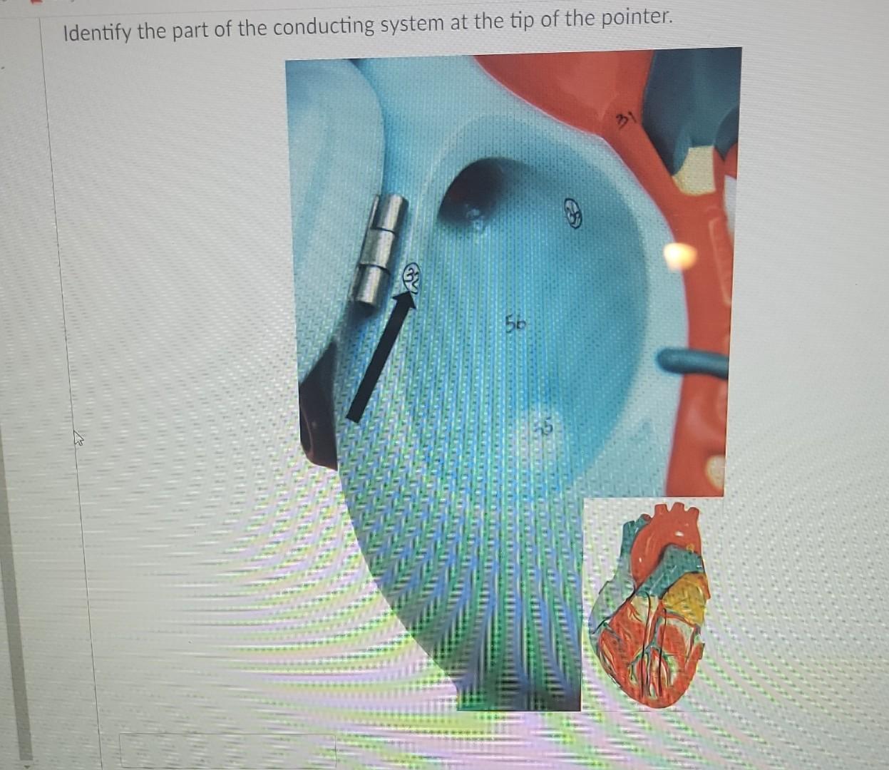 Solved Identify the part of the conducting system at the tip | Chegg.com