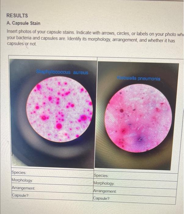 Solved A. Capsule Stain Insert photos of your capsule | Chegg.com
