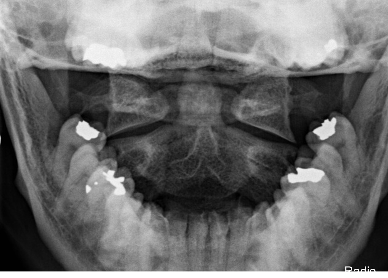Solved Draw on and label this open mouth radiograph to | Chegg.com