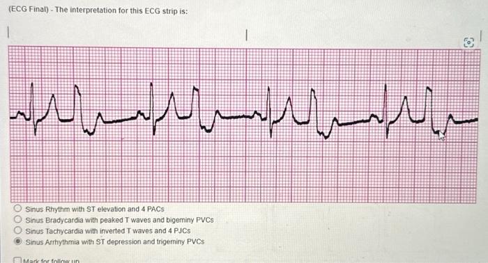 Solved (ECG Final) - The interpretation for this ECG strip | Chegg.com
