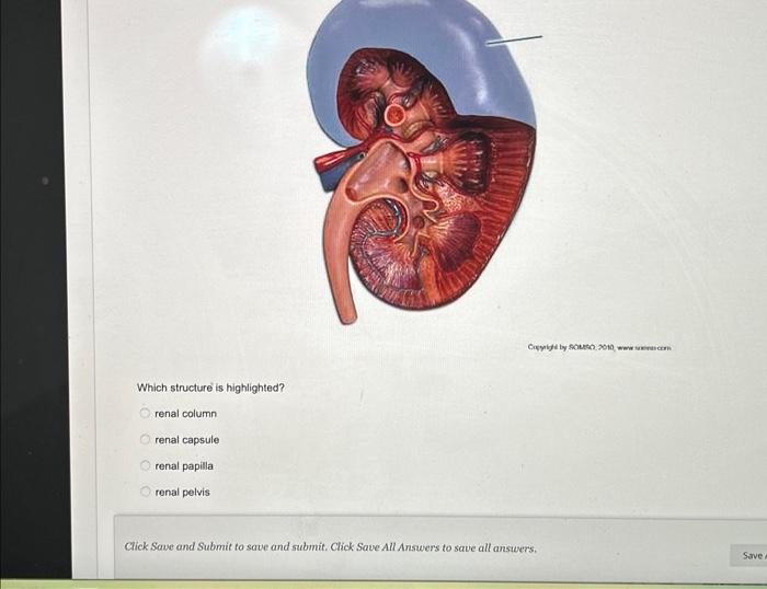 Solved Gikyigh ty soush 2019 wwa sevuscm Which structure is | Chegg.com
