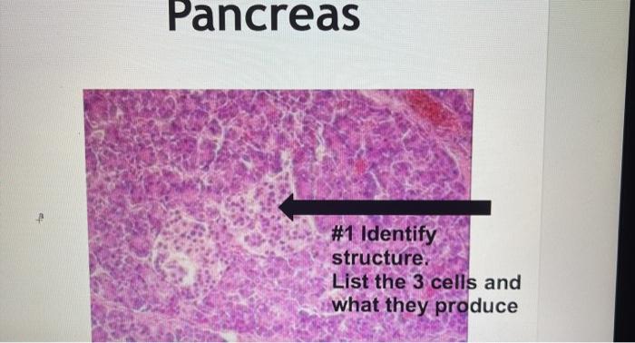 Solved Pancreas #1 Identify structure, List the 3 cells and | Chegg.com