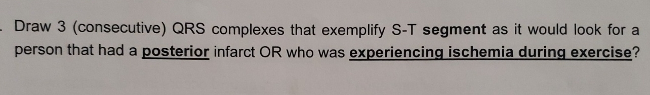 Solved Draw 3 (consecutive) ﻿QRS complexes that exemplify | Chegg.com