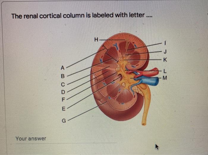Solved In the proximal convoluted tubule, the cells are | Chegg.com