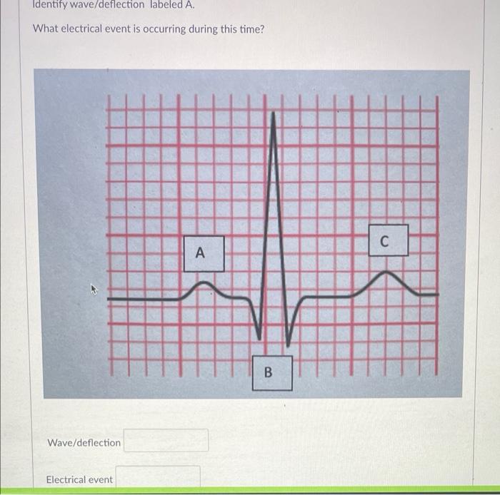Solved PR = seconds Identify wave/deflection labeled A. | Chegg.com