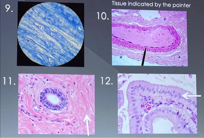 Solved 9. Tissue indicated by the pointer 10. 11. | Chegg.com