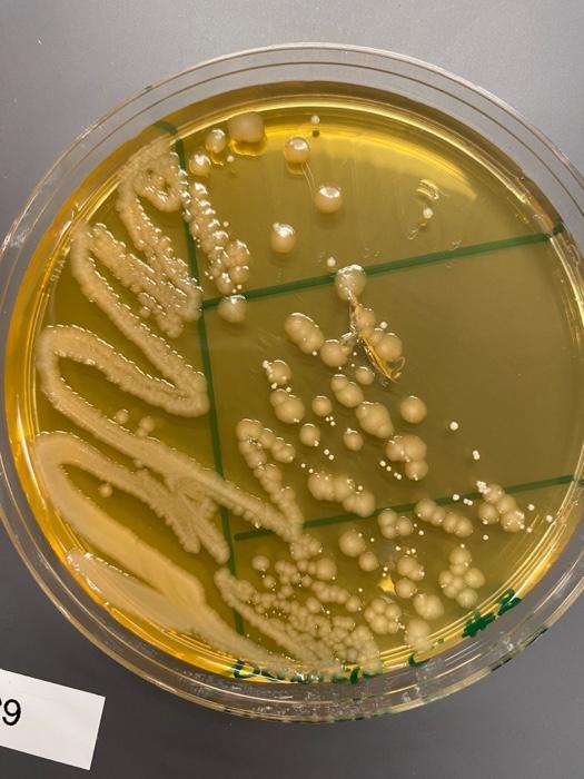 Both agar plates contain two different bacteria. | Chegg.com