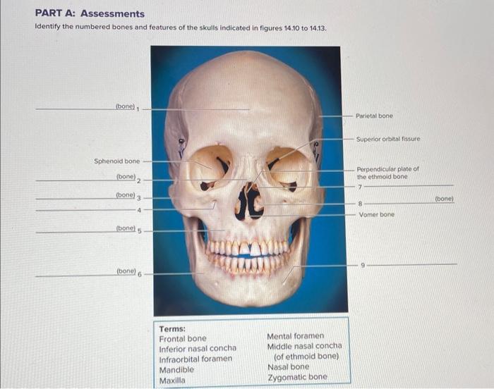 Solved PART A: Assessments Identify the numbered bones and | Chegg.com Solved PART A: Assessments Identify the numbered bones and | Chegg.com