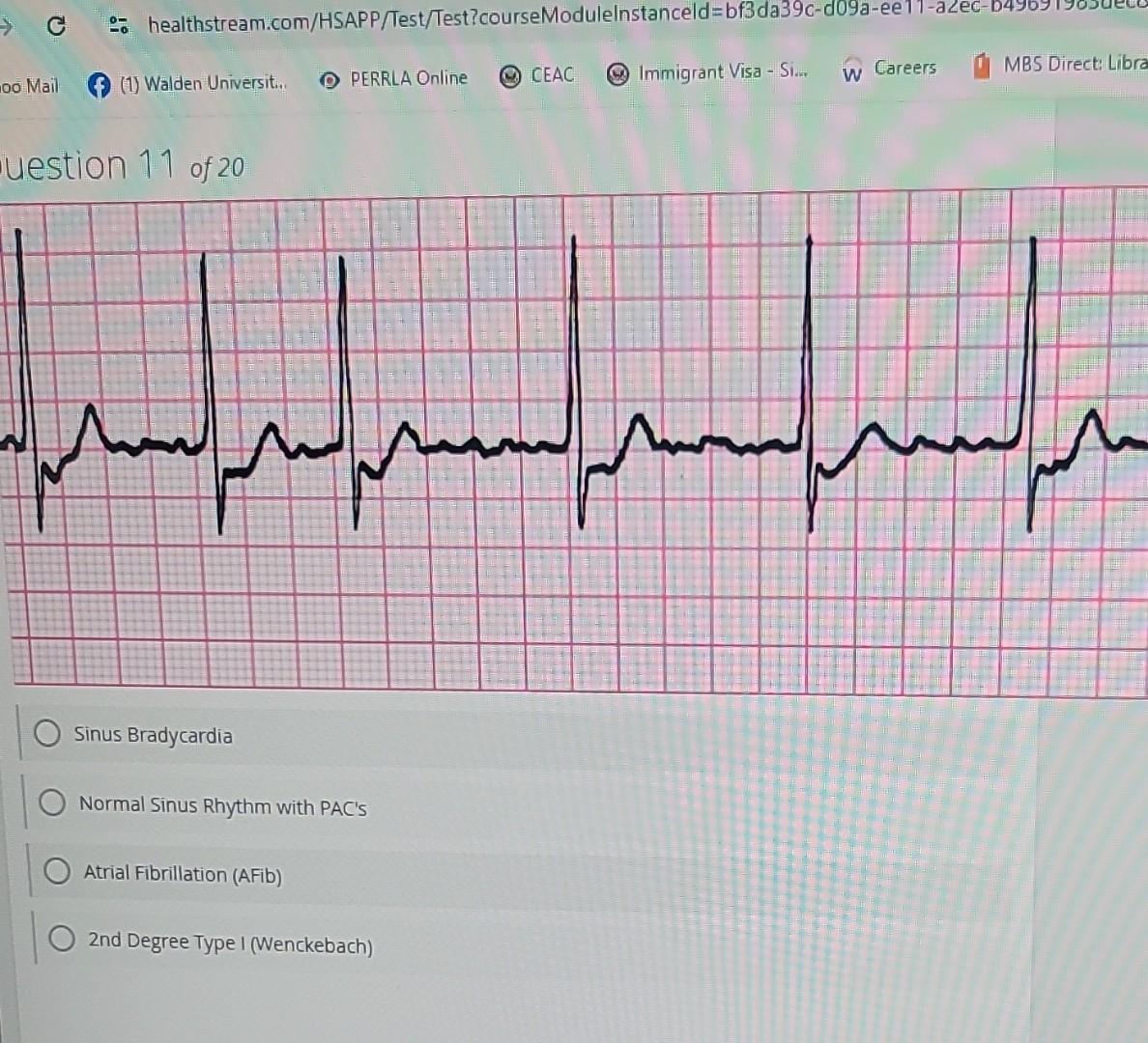 Solved Uestion 11 of 20 Sinus Bradycardia Normal Sinus | Chegg.com