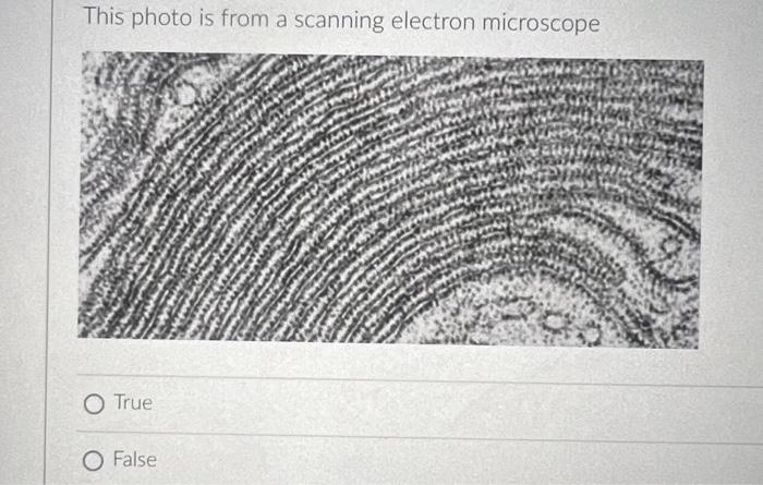 This photo is from a scanning electron microscope | Chegg.com