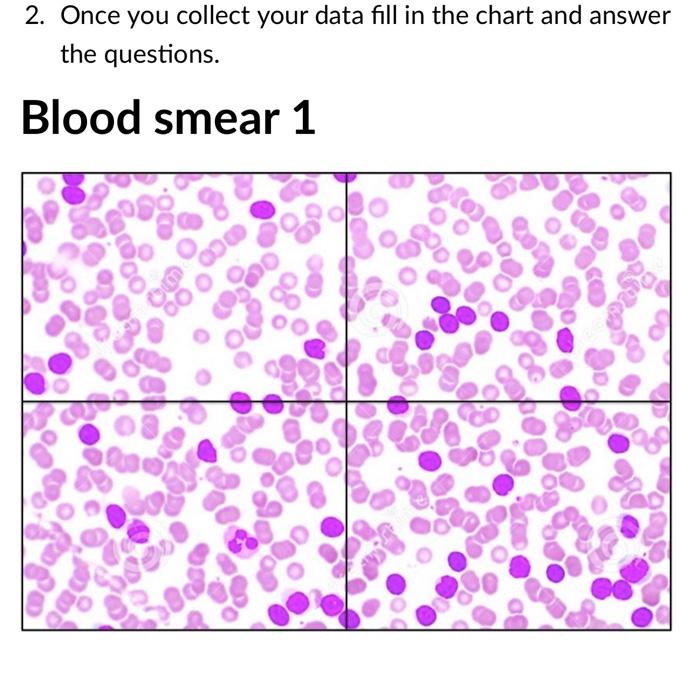 1. Using the blood smear image below count and | Chegg.com