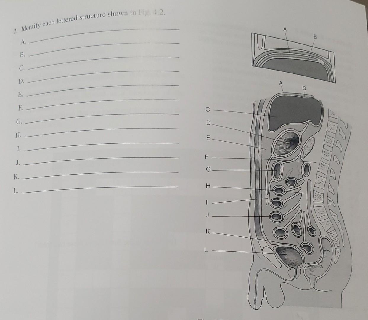 2. Identify each lettered structure shown in tigk 4.2 | Chegg.com