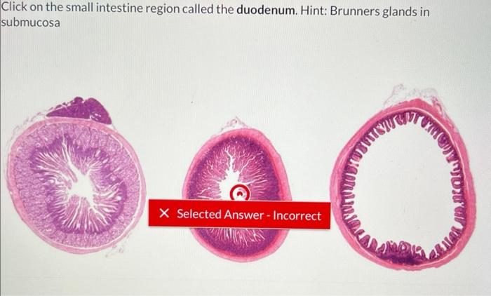 Solved Click on the small intestine region called the | Chegg.com