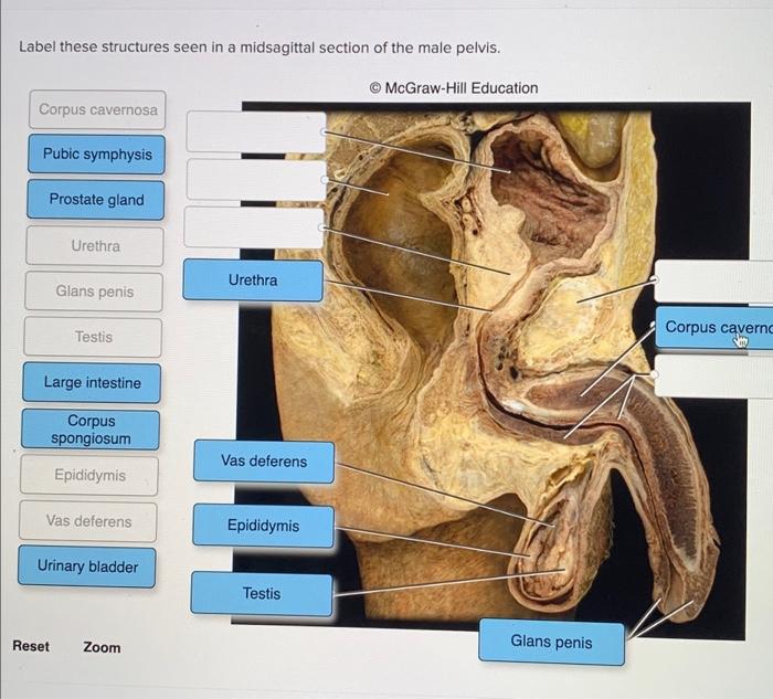 Solved Label these structures seen in a midsagittal section | Chegg.com Solved Label these structures seen in a midsagittal section | Chegg.com