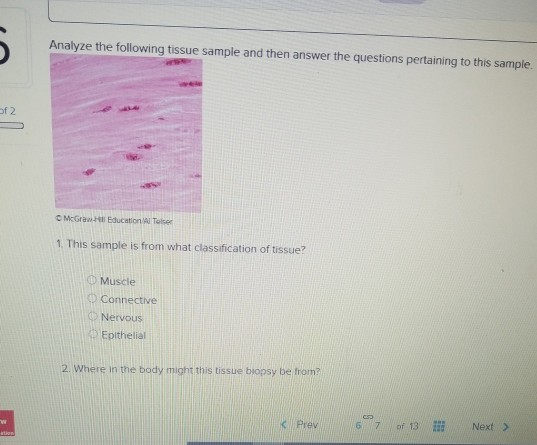 Analyze The Following Tissue Sample And Then Answer