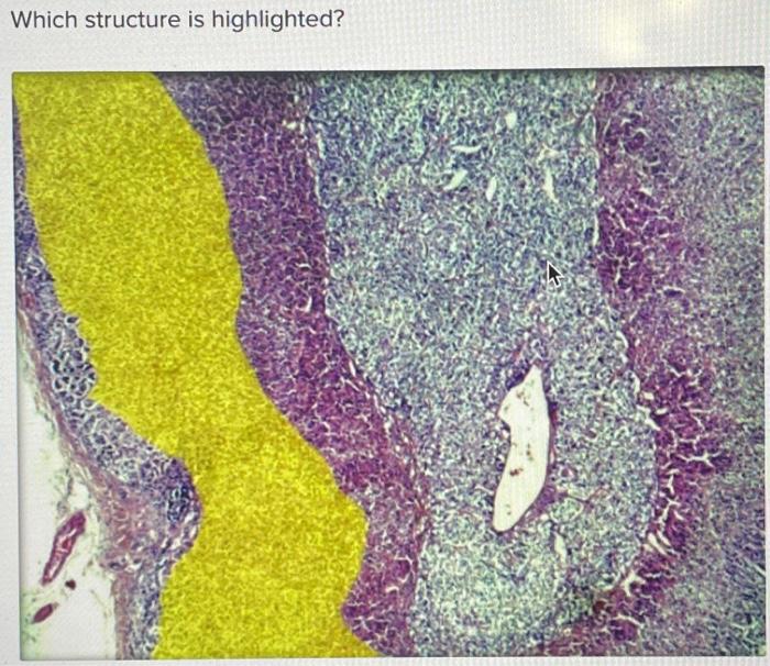 Solved Which structure is highlighted? Multiple Choice zona | Chegg.com