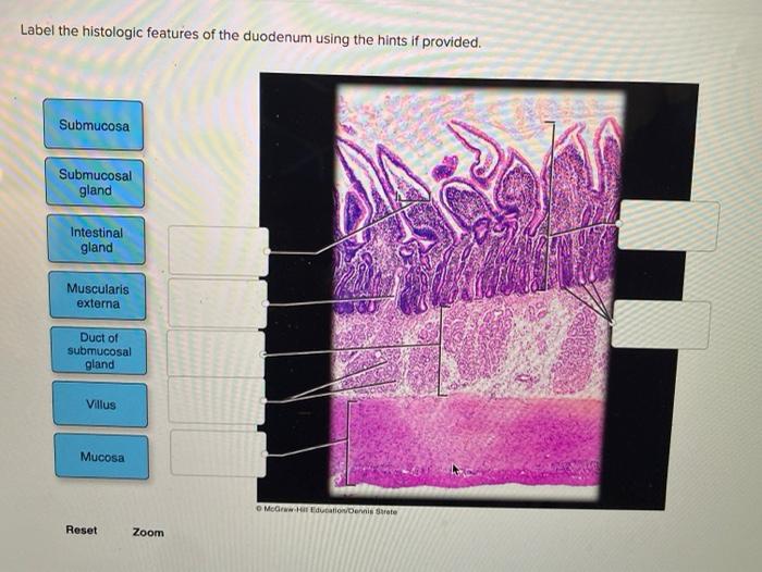 Solved Label the histologic features of the duodenum using | Chegg.com