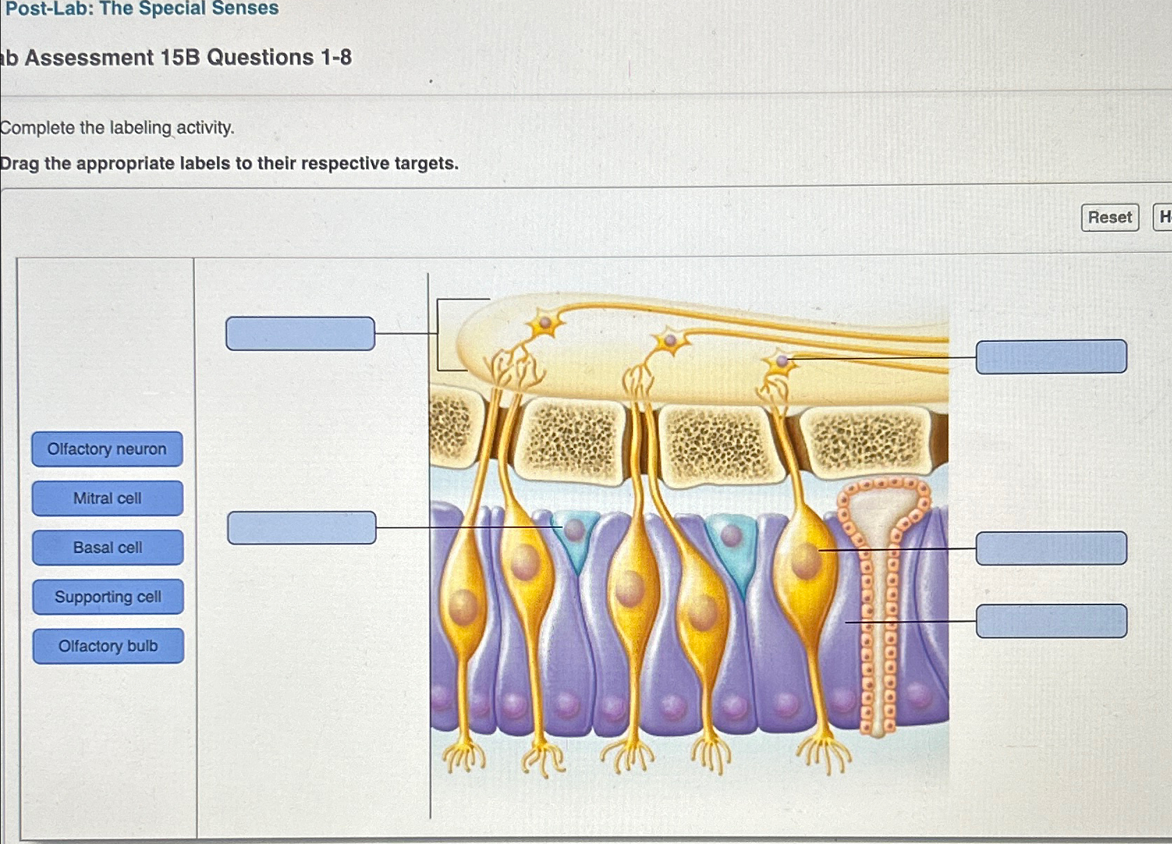 Solved Post-Lab: The Special Sensesb Assessment 15B | Chegg.com