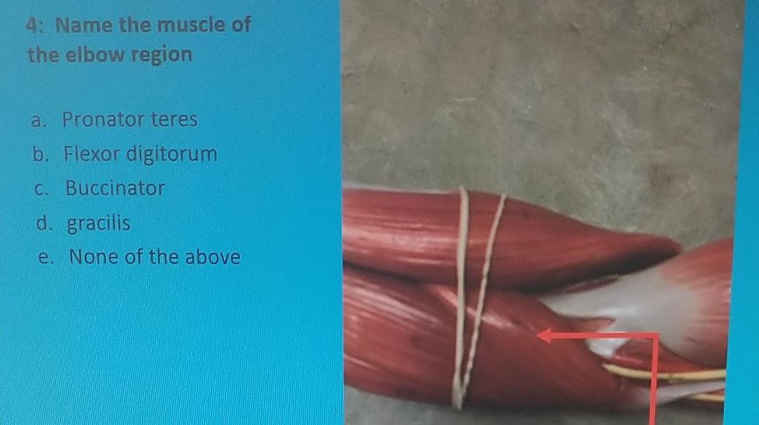 Solved 4: Name the muscle of the elbow region a. Pronator | Chegg.com