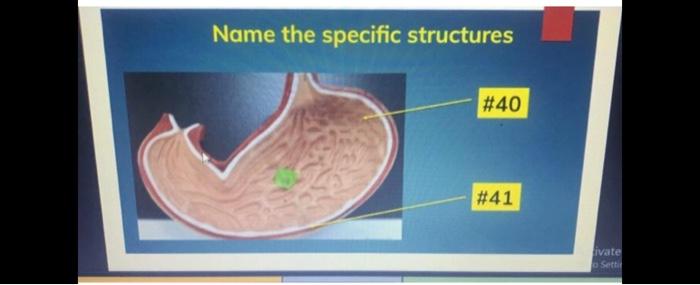 Solved Name the specific structure #46 #47 Name the | Chegg.com