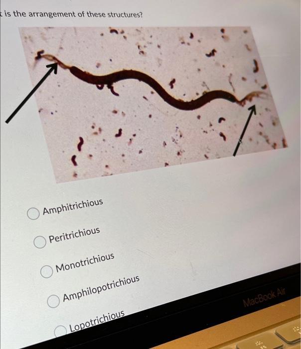 Solved t is the arrangement of these structures? | Chegg.com
