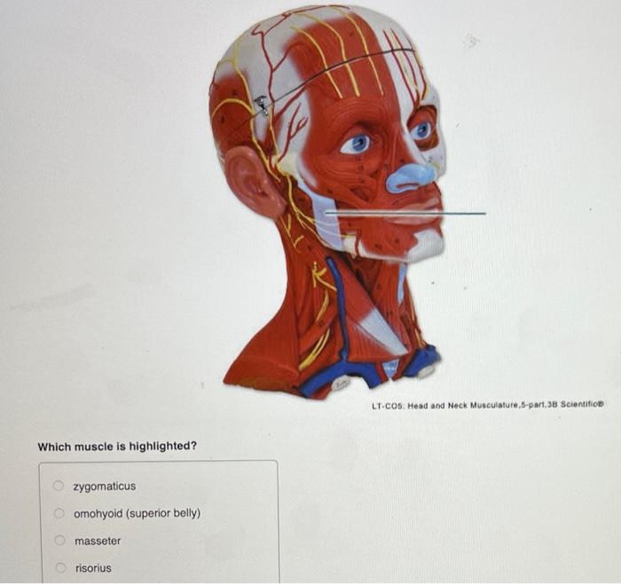Solved Which muscle is highlighted? zygomaticus omohyoid | Chegg.com