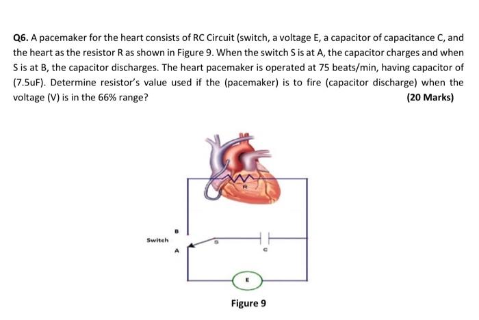 Solved Q6. A pacemaker for the heart consists of RC Circuit | Chegg.com