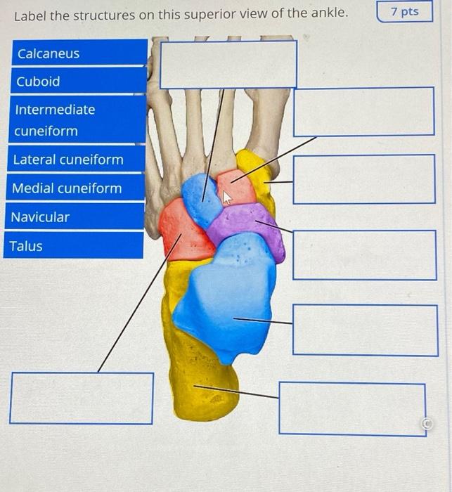 Solved Label the structures on this superior view of the | Chegg.com