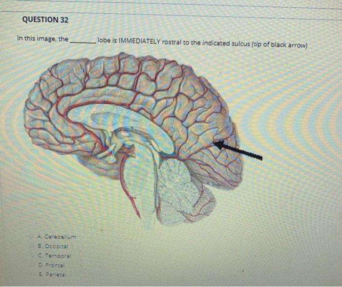 Solved QUESTION 32 In this image, the _lobe is IMMEDIATELY | Chegg.com