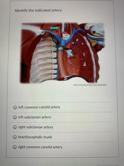 Solved Identify the indicated artery: left common carotid | Chegg.com