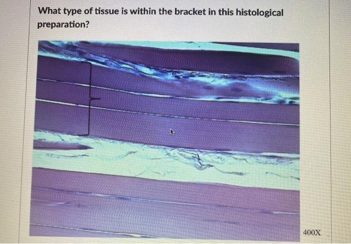 Solved What type of tissue is within the bracket in this | Chegg.com