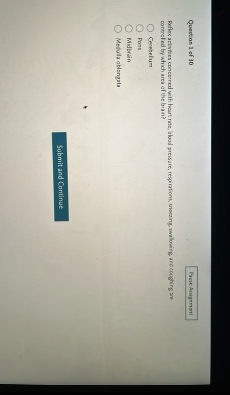 Solved Question 1 ﻿of 30Reflex activities concerned with | Chegg.com