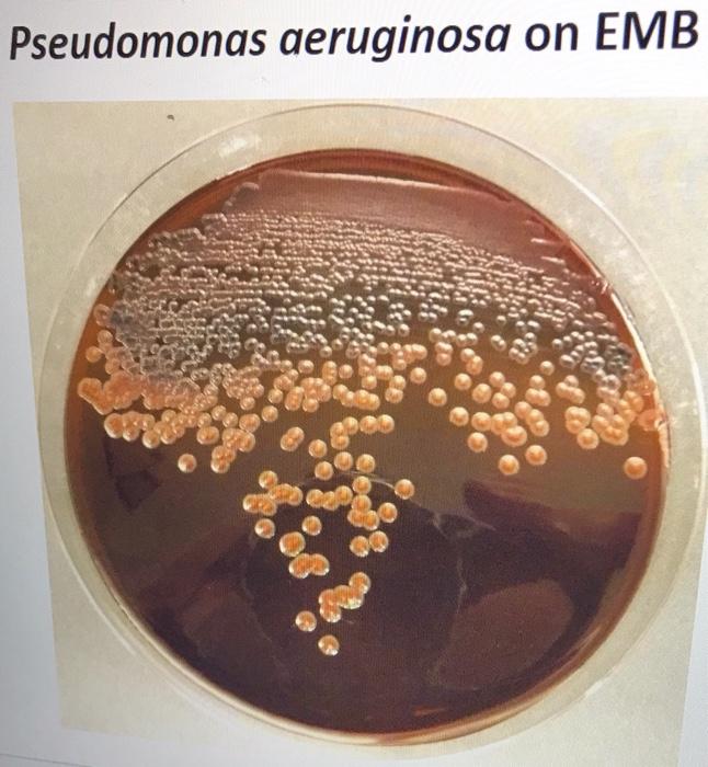 Solved Pseudomonas aeruginosa on EMB | Chegg.com