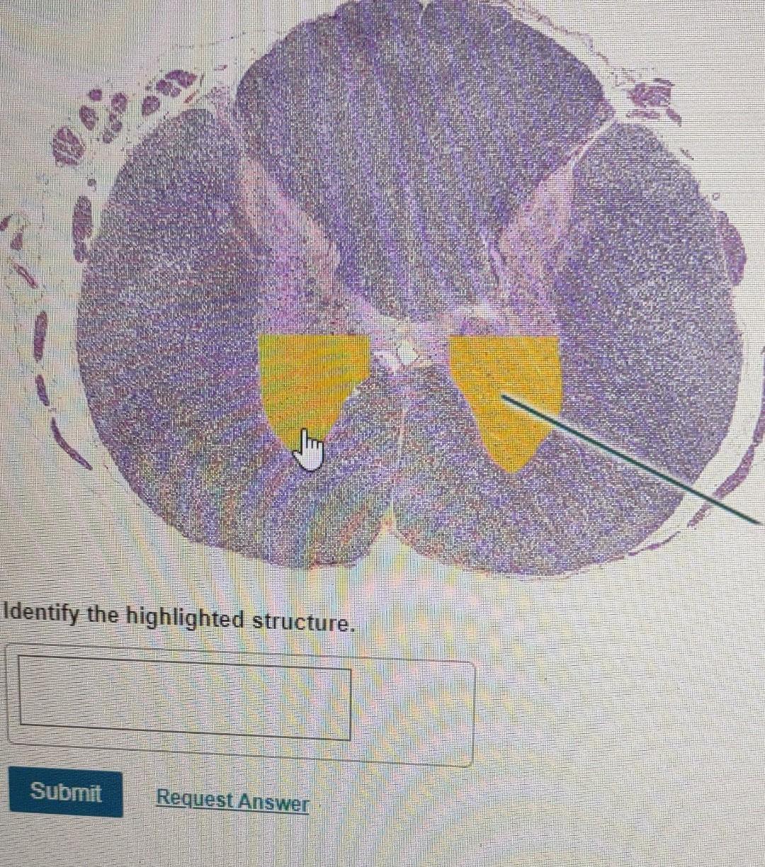 Solved Identify the highlighted structure. | Chegg.com