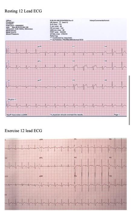 Exercise ECG Resting ECG Using the bottom | Chegg.com