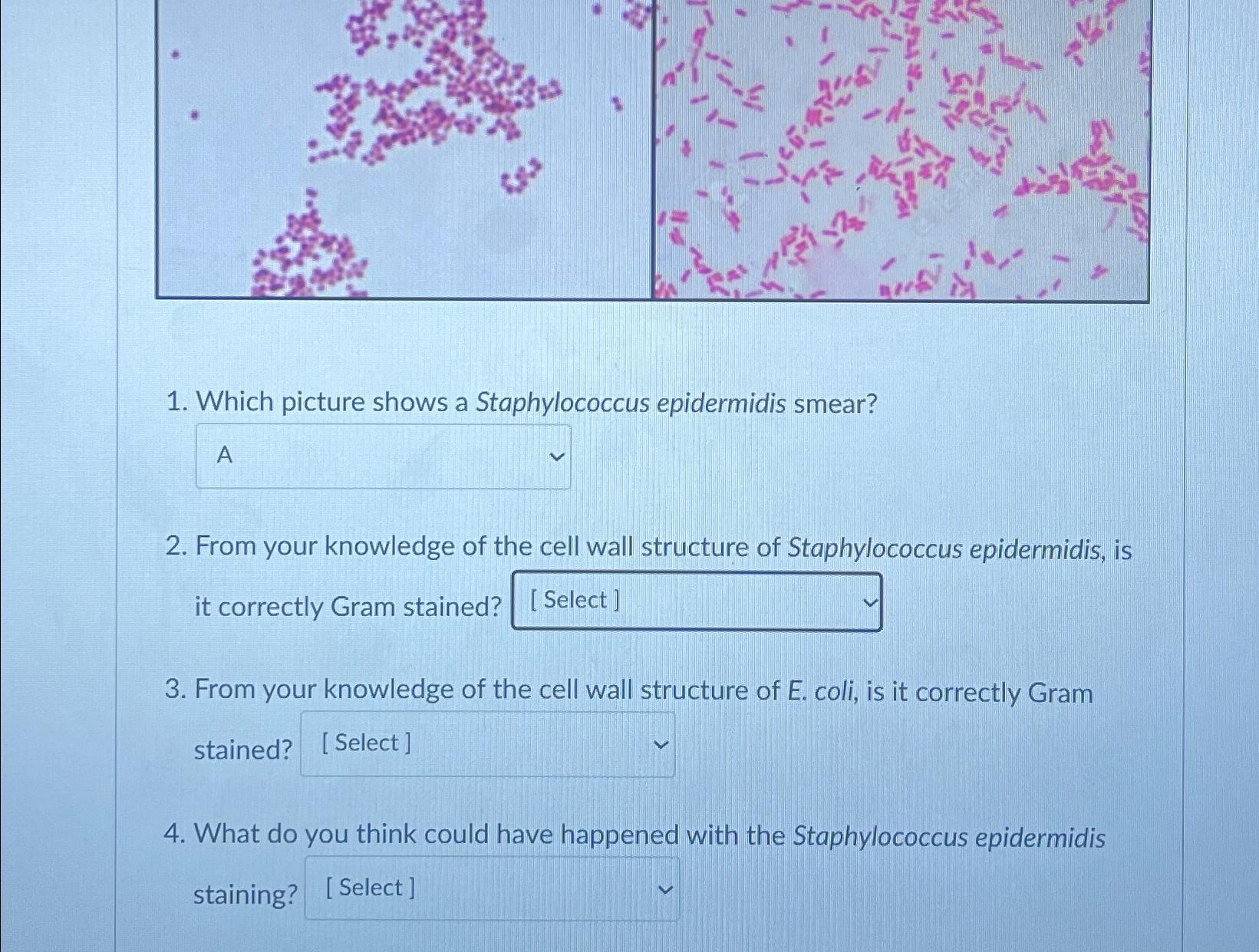 Solved Which picture shows a Staphylococcus epidermidis | Chegg.com