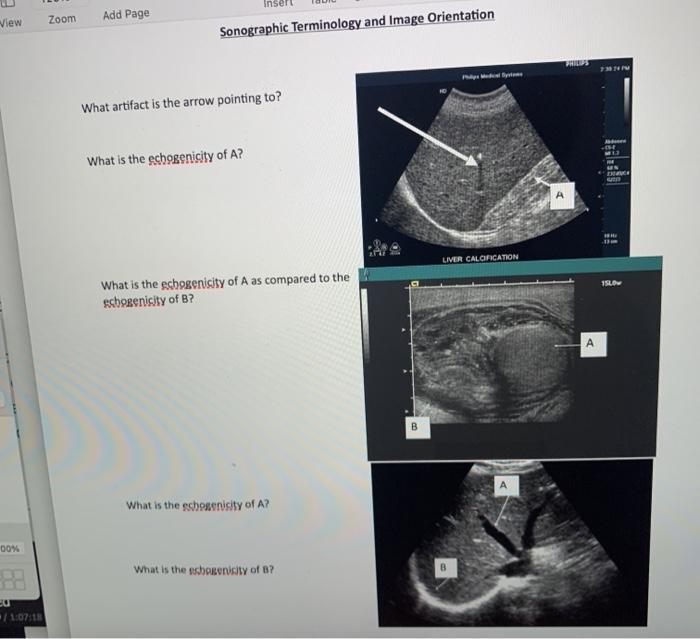 Solved View Zoom Add Page Sonographic Terminology and Image | Chegg.com