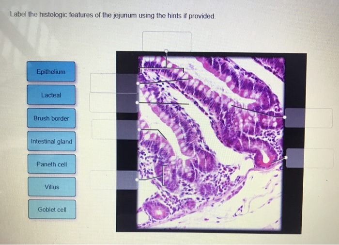 Solved Label the histologic features of the jejunum using | Chegg.com