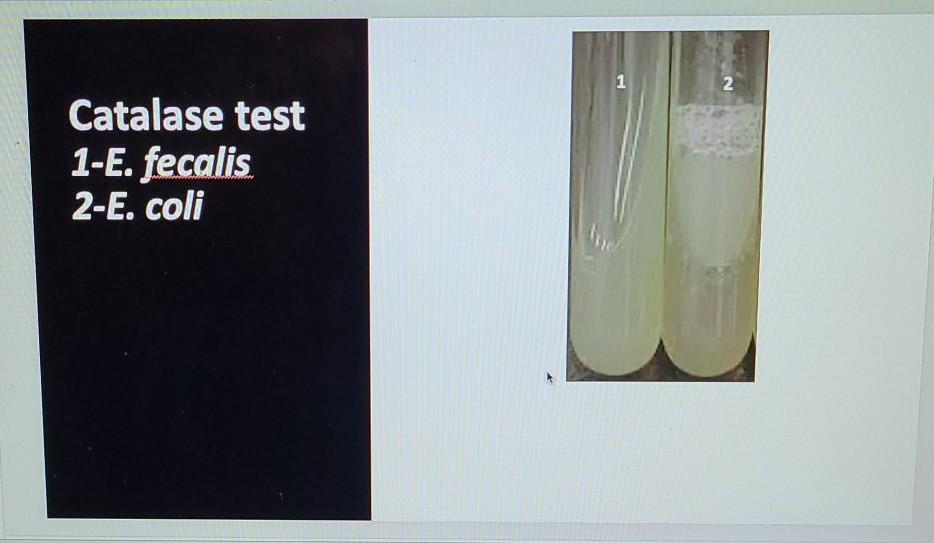 Solved Starch Agar-Looking at the results presentation | Chegg.com