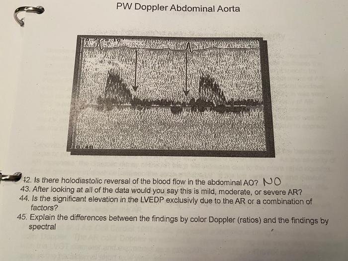 PW Doppler Abdominal Aorta 42. Is there holodiastolic | Chegg.com