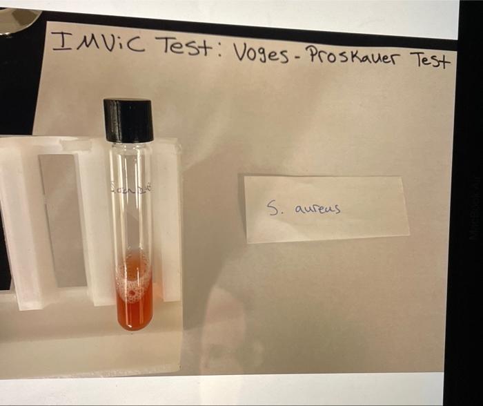 Solved PART B: Methyl Red Test and Voges-Proskauer Test | Chegg.com