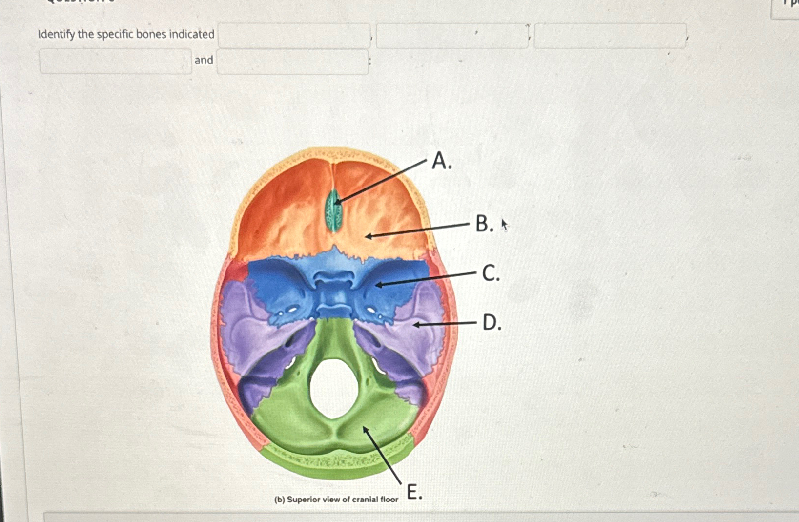 Solved Identify the specific bones indicatedand | Chegg.com