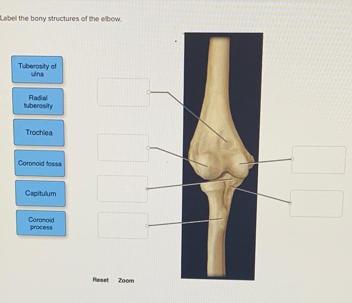 Solved Label the bony structures of the elbow. Tuberosity of | Chegg.com