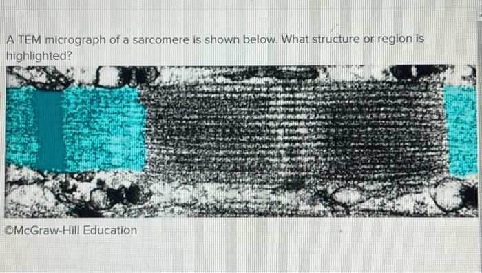 Solved A TEM micrograph of a sarcomere is shown below. What | Chegg.com