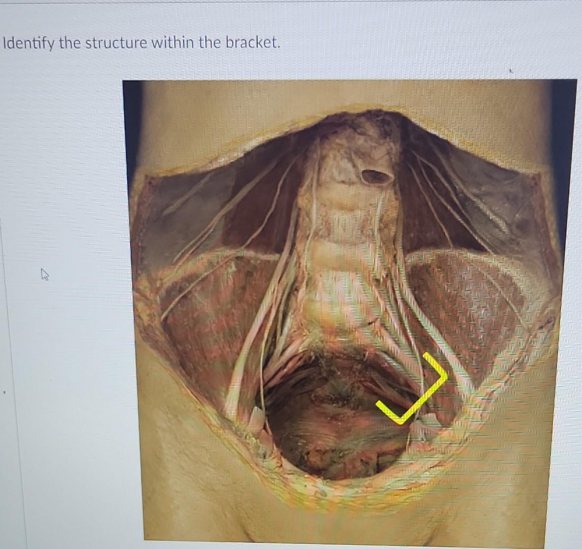 Solved Identify the single white structure indicated by the | Chegg.com Solved Identify the single white structure indicated by the | Chegg.com