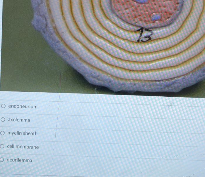 Solved O endoneurium O axolemma O myelin sheath cell | Chegg.com