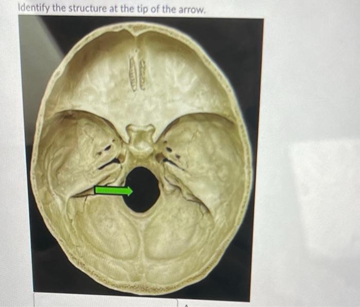 Solved Idanbicu. the Identify the bone at the tip of the | Chegg.com