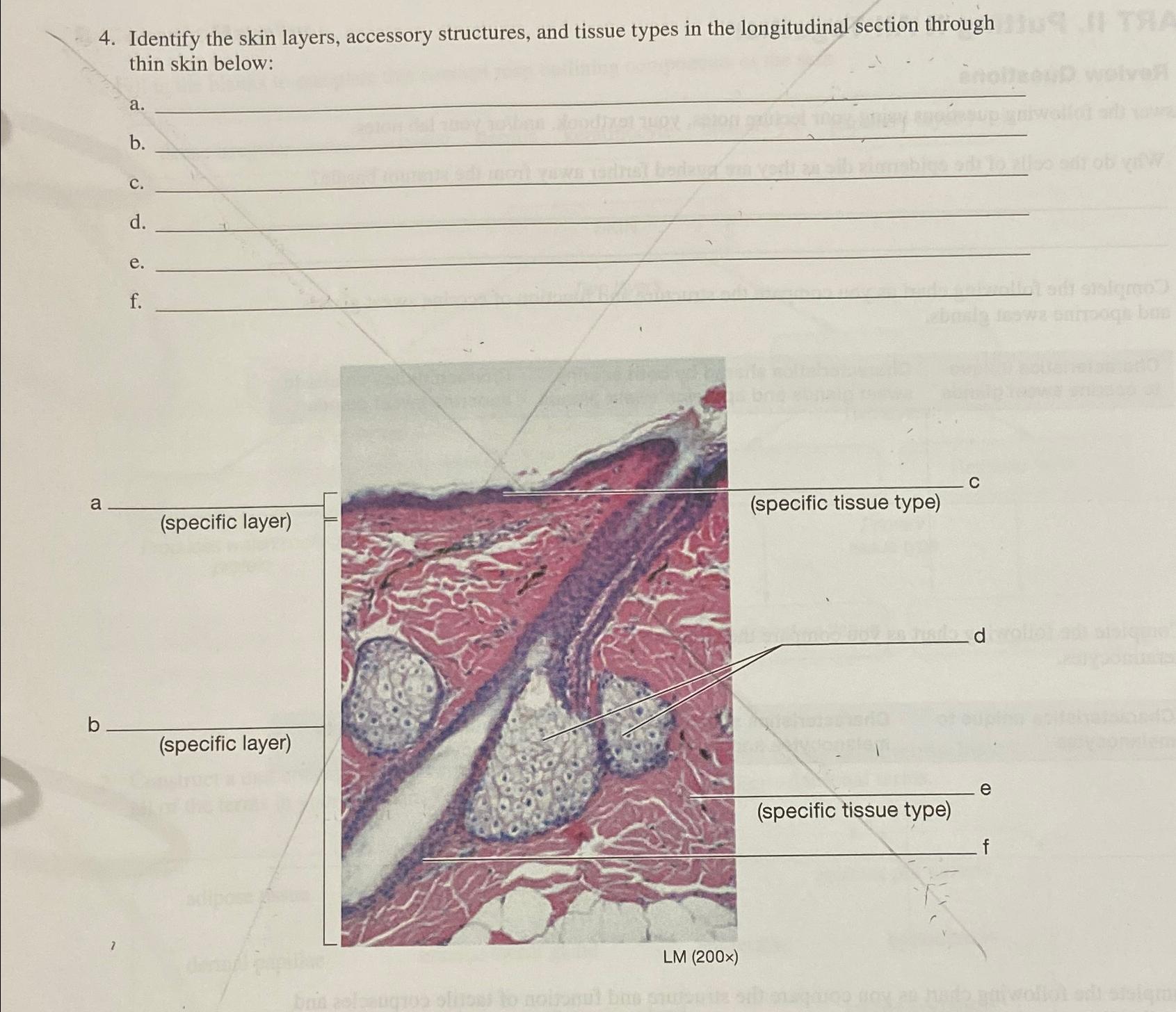 Identify the skin layers, accessory structures, and | Chegg.com