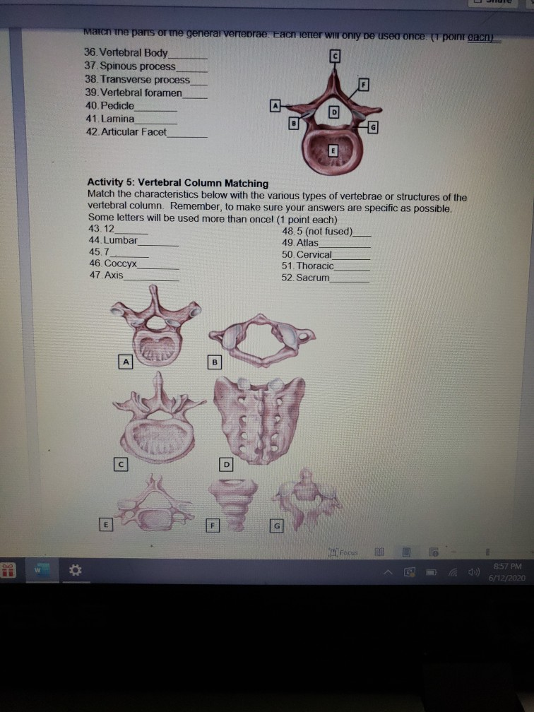 Solved Match the parts or the generar vertebrae. Each letter | Chegg.com