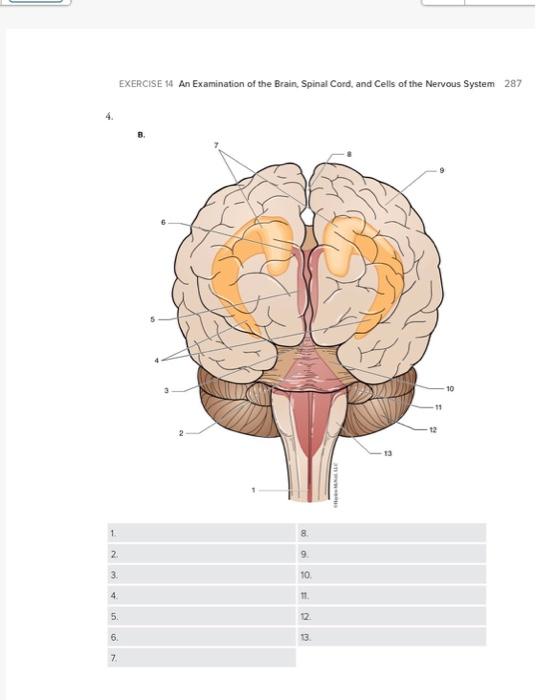 Solved EXERCISE 14 An Examination of the Brain Spinal Cord, | Chegg.com